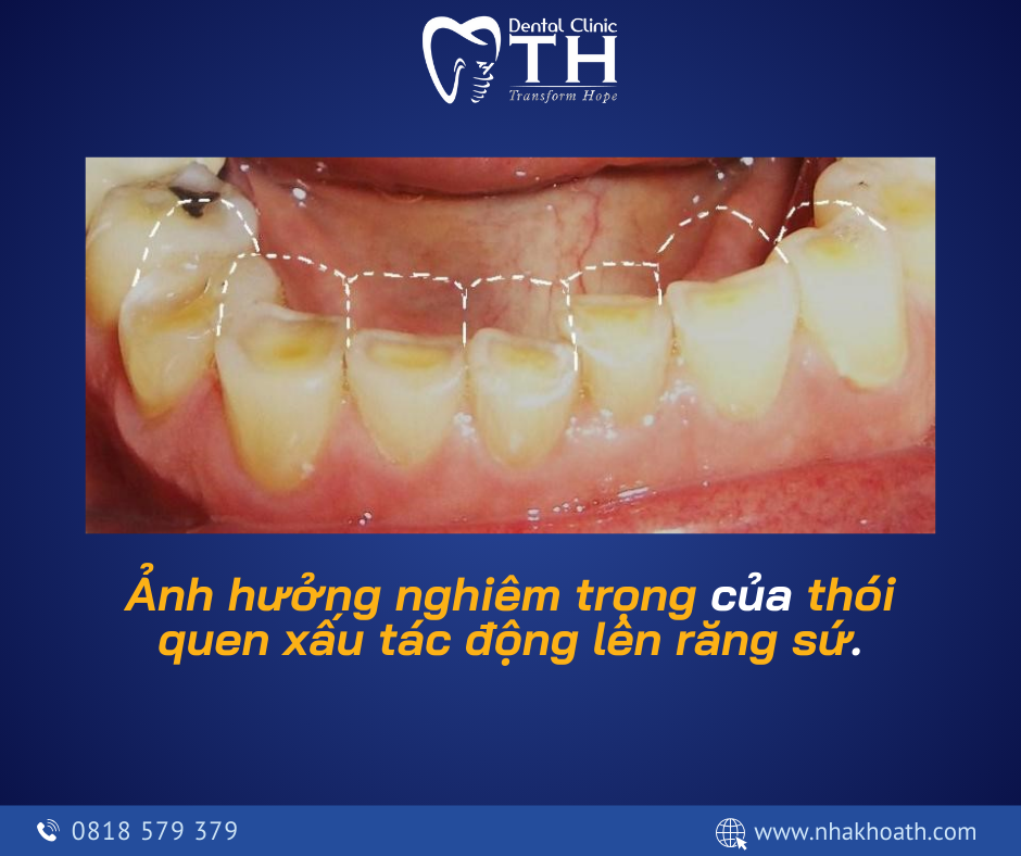 Nha khoa nổi tiếng tại tphcm có lab | Nha khoa TH