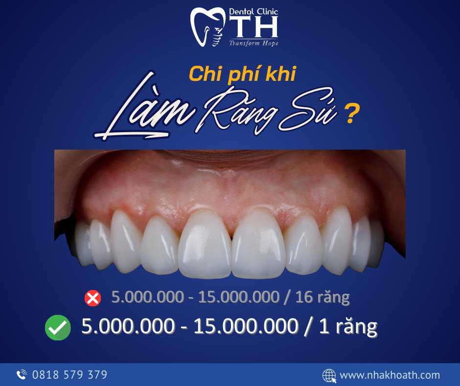 Nha khoa nổi tiếng tại tphcm có lab | Nha khoa TH