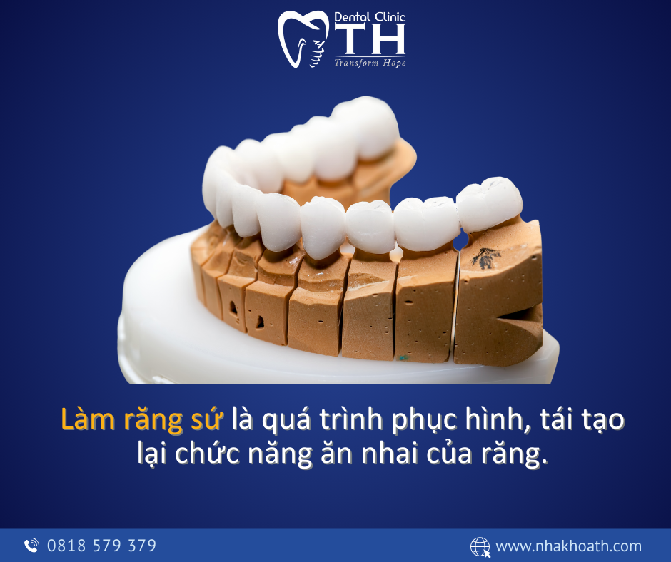 Các loại răng sứ phổ biến trong Labo của Nha Khoa TH | Nha khoa TH
