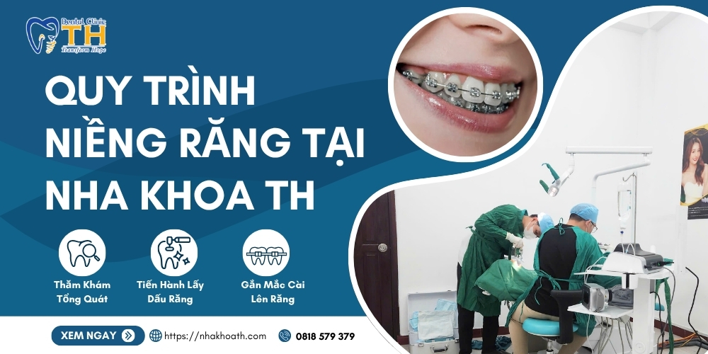 Quy Trình Niềng Răng | Nha khoa TH